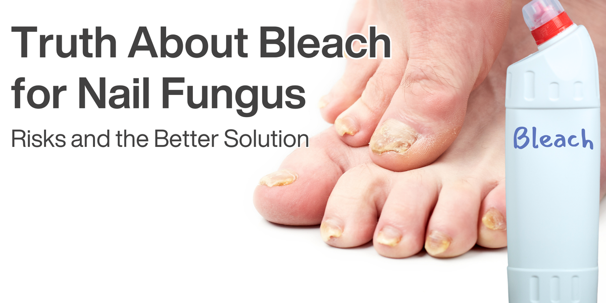 The Truth About Bleach for Toenail Fungus: Risks and the Better Soluti ...