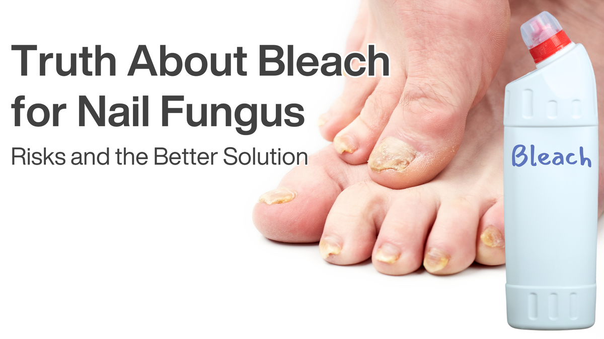 The Truth About Bleach for Toenail Fungus: Risks and the Better Soluti ...